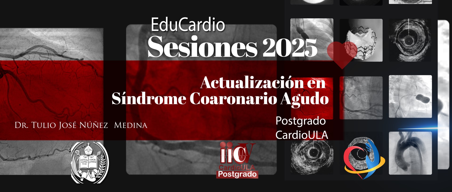 Sesiones e-learning sobre Actualización de Protocolo de Manejo del Síndrome Coronario Agudo ...